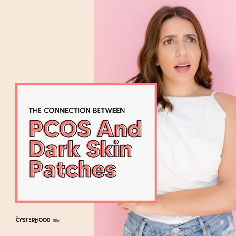 The Connection Between PCOS And Dark Skin Patches