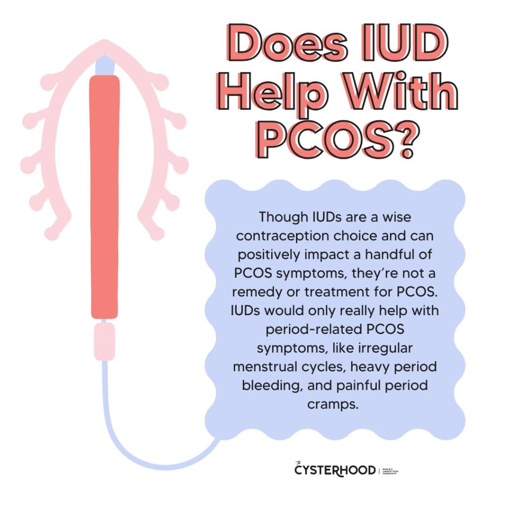 Are There Problems With PCOS And IUD Use? - PCOS Weightloss