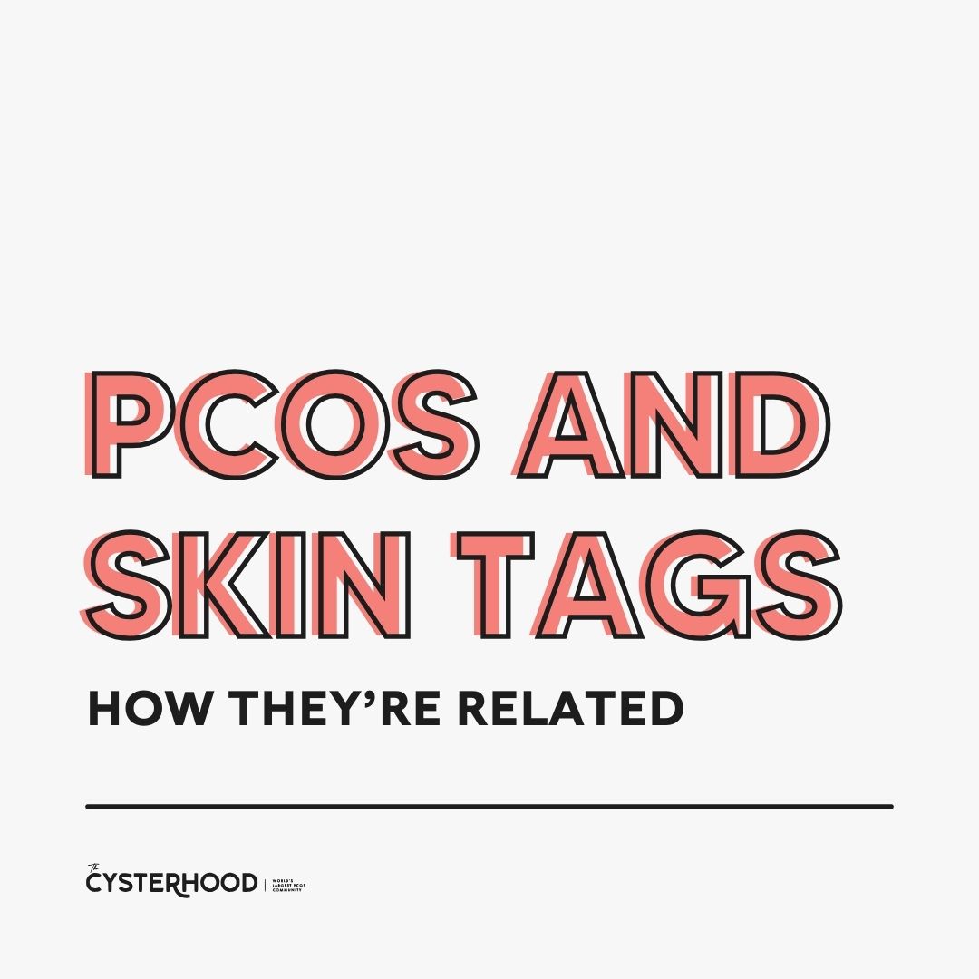 PCOS And Skin Tags: How They’re Related - PCOS Weightloss
