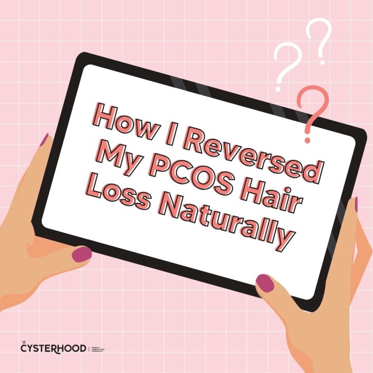 Reverse PCOS Hair Loss Naturally Via Lifestyle Change & Diet